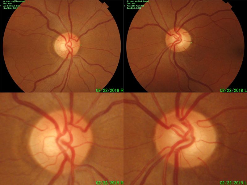 RETINOGRAFIA COLORIDA - Hospital de Olhos Videira